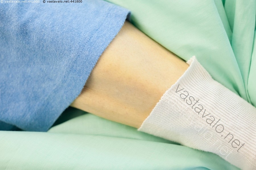 Kuva: Sairaalan vaatteissa - lakana lahje pohje jalka sukka ...